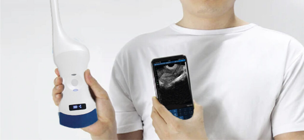 Sonostar Convex Transvaginal – El panta